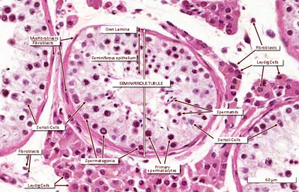 Anatomy of the boar | Magapor