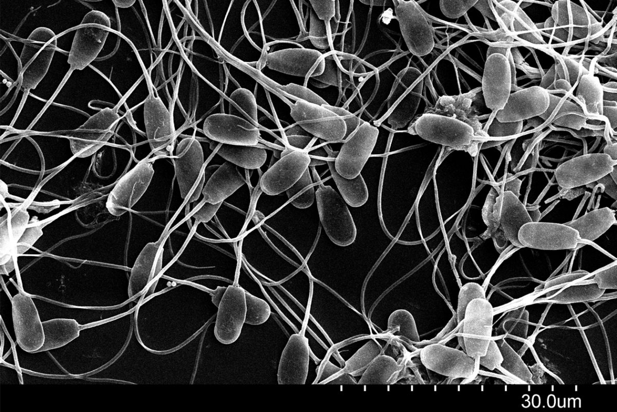 Plasma Seminal: Qué contiene y cuál es su función | Magapor