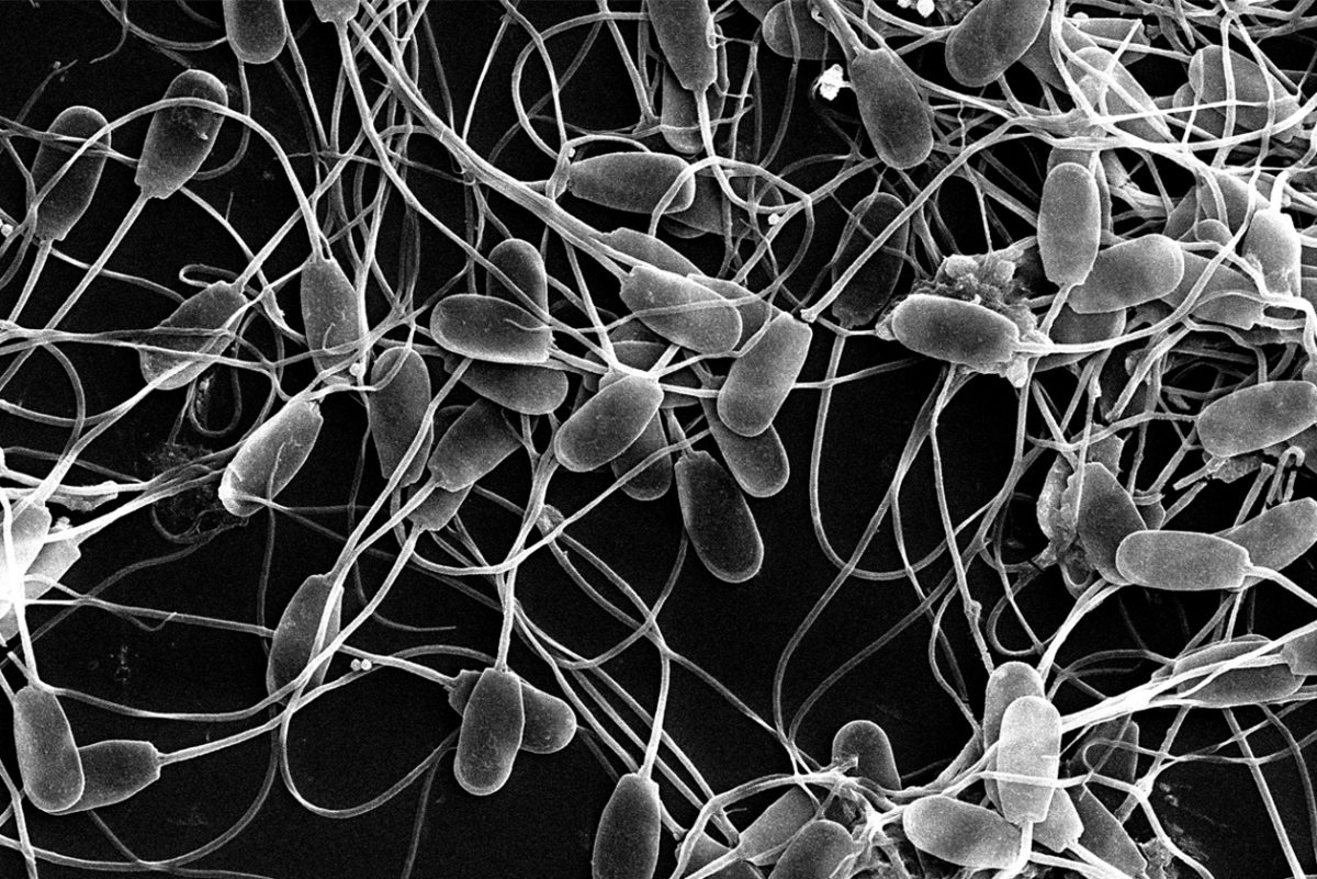 La célula espermática: espermiogénesis | Magapor